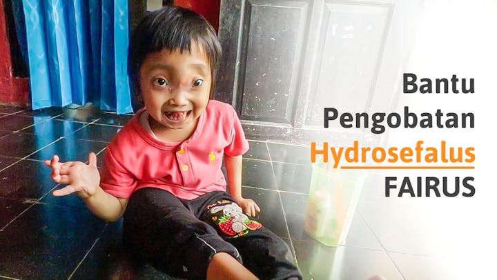Sharing Happiness | #BuatBahagia dan Bantu Fairus sembuh dari Hidrosefalus.
