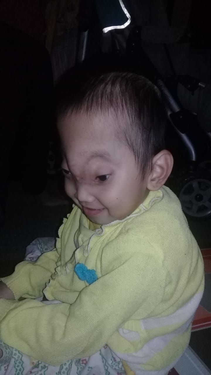 Sharing Happiness | Bantu Fairus Sembuh dari Hidrosefalus #SenyumSehat