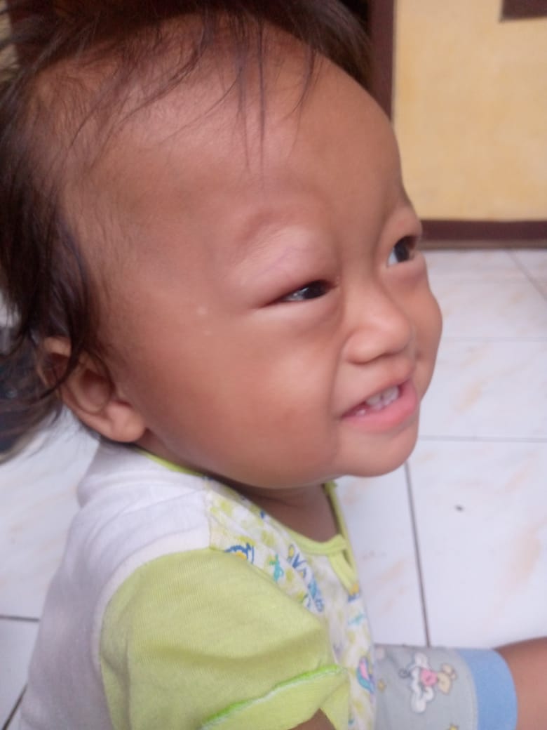 Sharing Happiness | Nyawanya Terancam, Bayi 1 Tahun Idap Tumor Ganas!